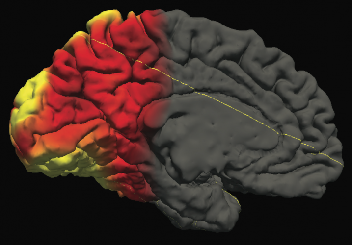 Cambridge Research Systems - Visual Cortex Phased-Array MRI Coil