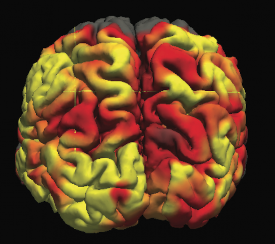 Cambridge Research Systems - Visual Cortex Phased-Array MRI Coil