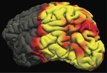 Cambridge Research Systems - 32 channel Visual Cortex Phased-Array MR ...